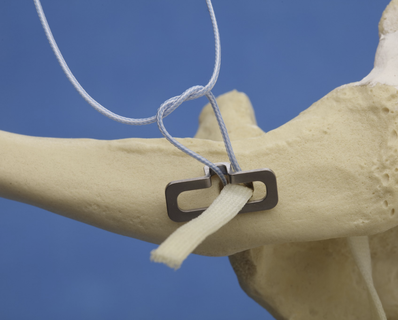 CC-Instrument – CC Clip Implant System